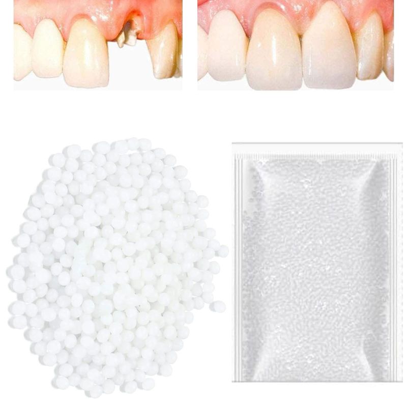 TOUFEIYUAN Dentures, Dental Cement, Dental Glue, False Teeth, Chipped ...