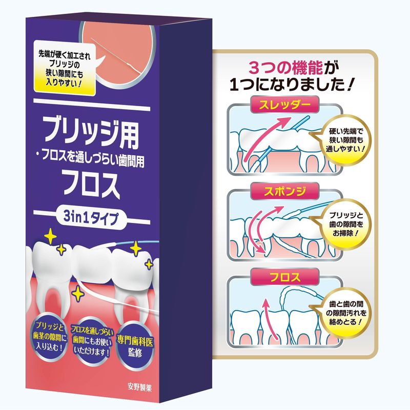 (Orthodontic Supervision) 3-in-1 Super Floss Bridge for Bridges ...