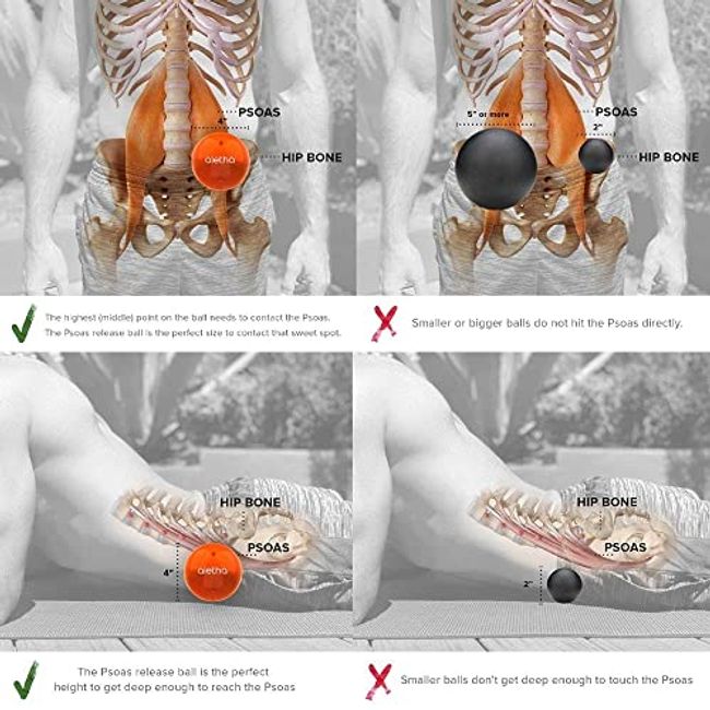 Psoas Muscle Trigger Point