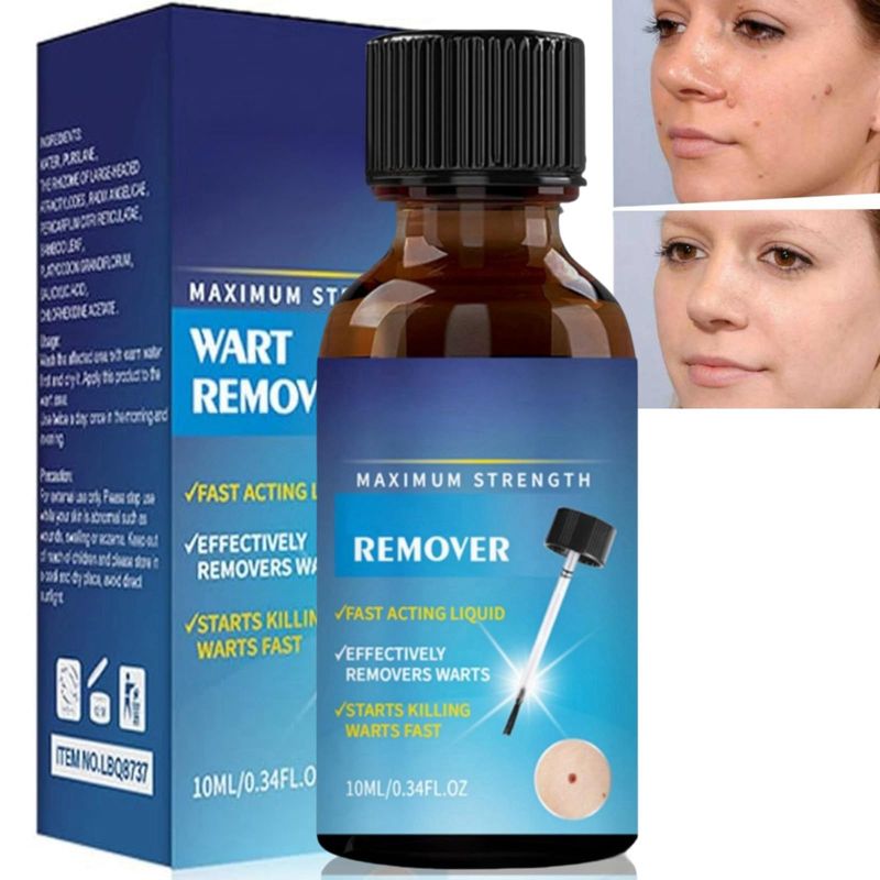 Wart Remover Fast Acting and Painless Skin Tag,Skin Tag Remover Liquid ...