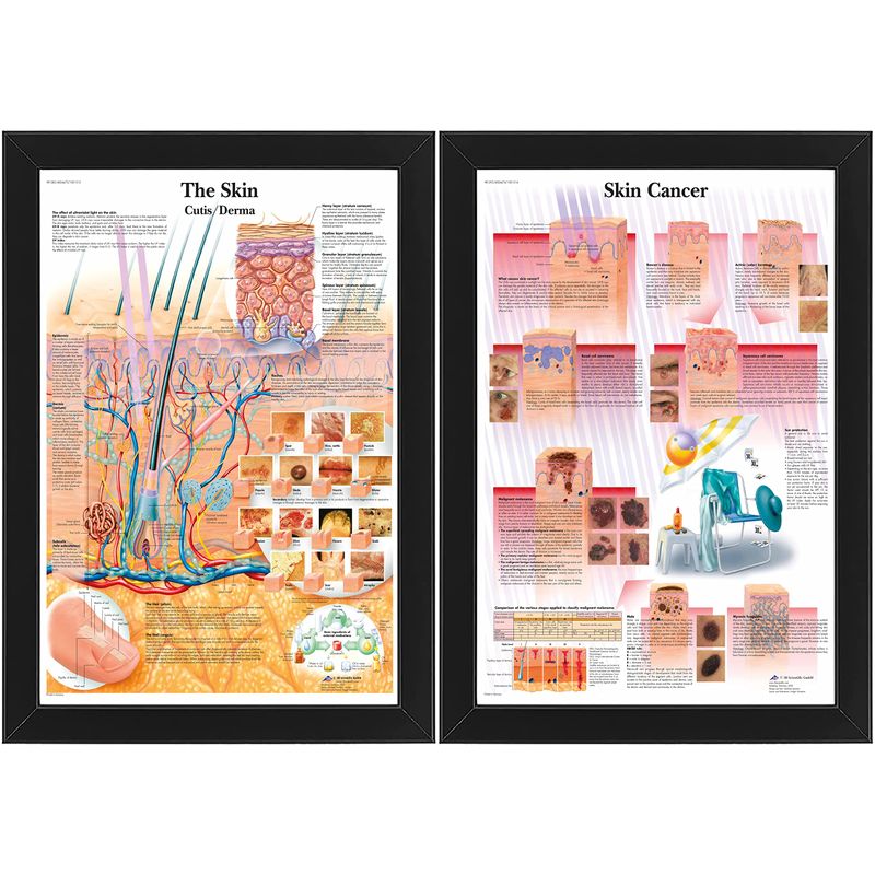 AllStarMedia The Skin & Skin Cancer - Human Body Anatomical System ...