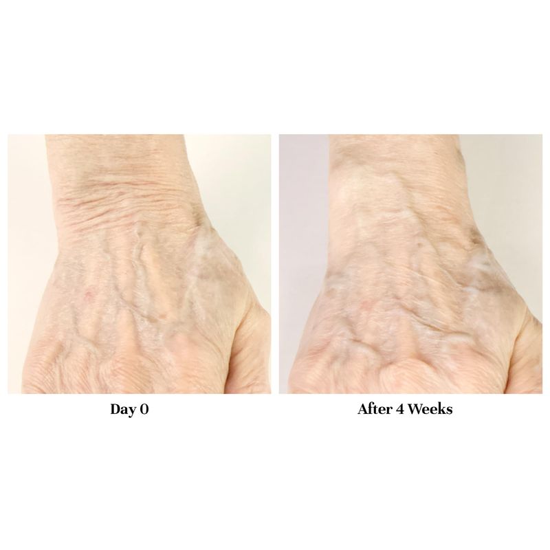 City Beauty Restoring Hand Treatment - Moisturizing Hand Cream - Dry ...