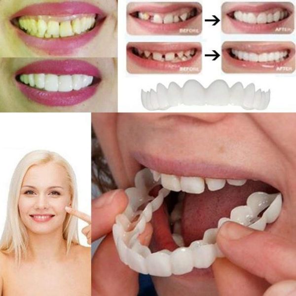 ZNXY 2PCS Dentures Fake Teeth Snap Instant and Confident on Smile ...