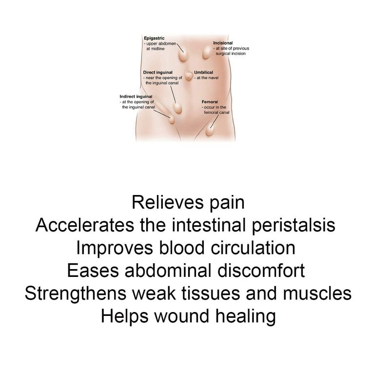 drdong Topical kids hernia formula-NO SURGERY, NO BELT, NO TABLET ...