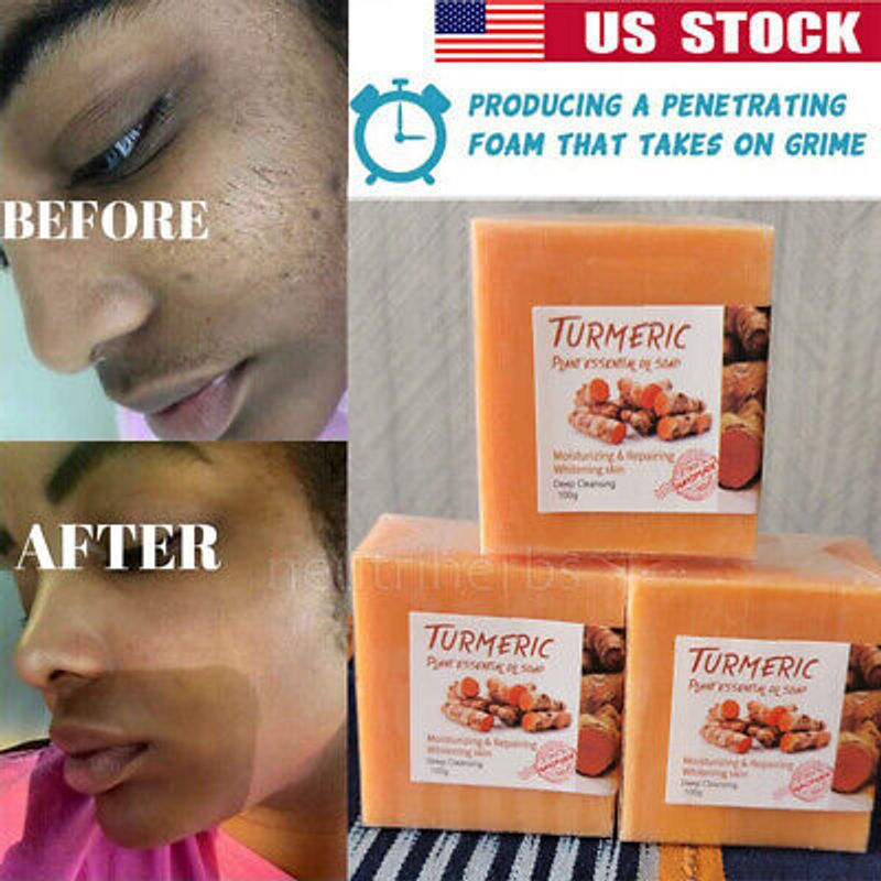 3 Pack Tumeric Soap Acne Dark Spots Removal Skin Whitening Body Bleaching Soap - Online ...