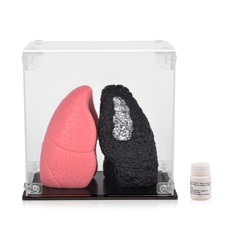 Ultrassist Healthy Lung vs. Smokers Lung Model Set, Lung Anatomy Model ...