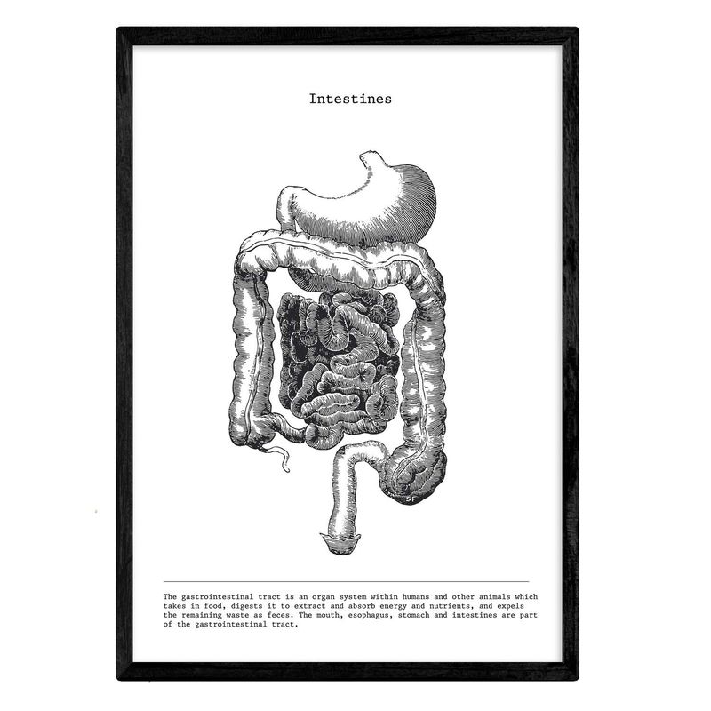 nacnic Prints Intestines Human Body Anatomy - Set of 1 - Unframed 8x11 ...