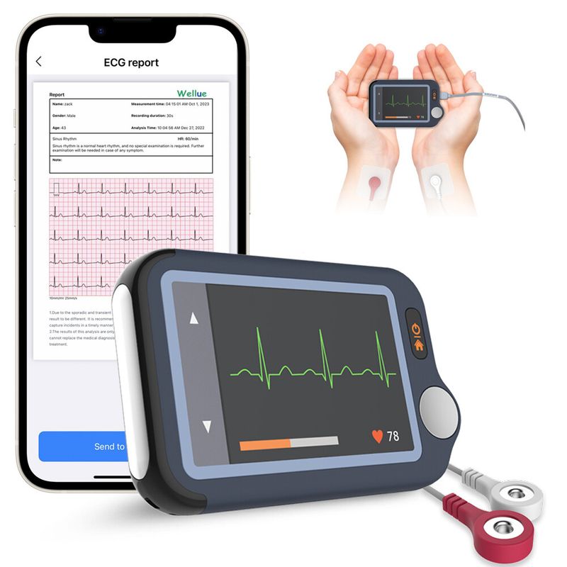 ECG EKG Monitor Heart Monitor with free AI ECG Analysis 30s/60s/5min ...
