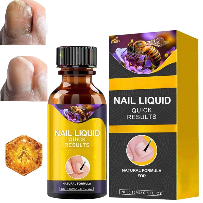 15ml Bee Venom Fast-Acting Anti-Fungal Nail for Toes and Fingers,Bee ...
