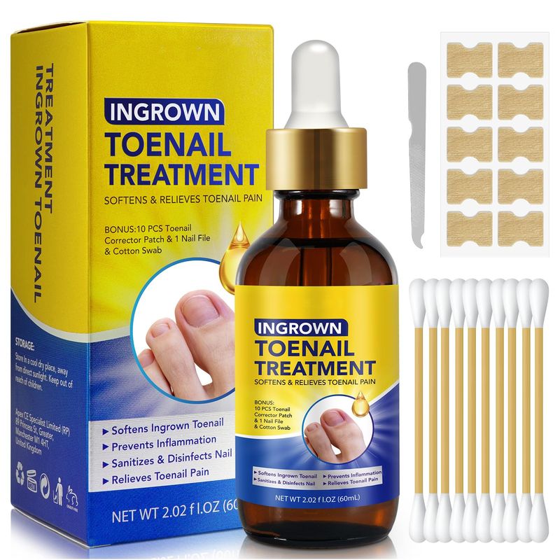 Ingrown Toenail Treatment, 60ml Ingrowing Toenail Kit, Toenail Anti ...