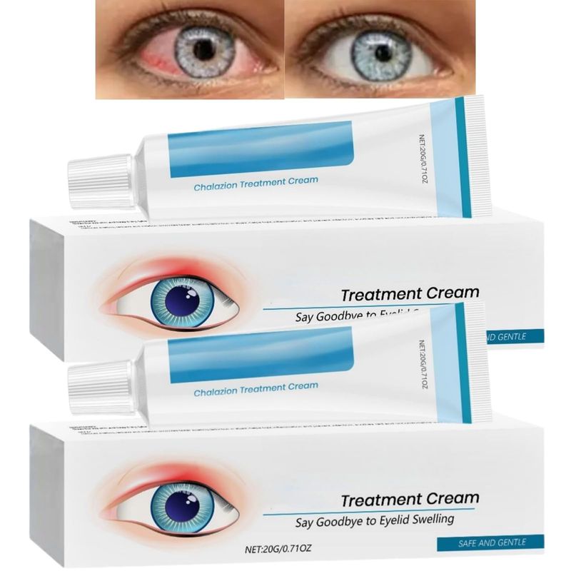 2PCS Chala/zion Eye Treatment Cream,Stye Eye Treatment,Moisturizing ...