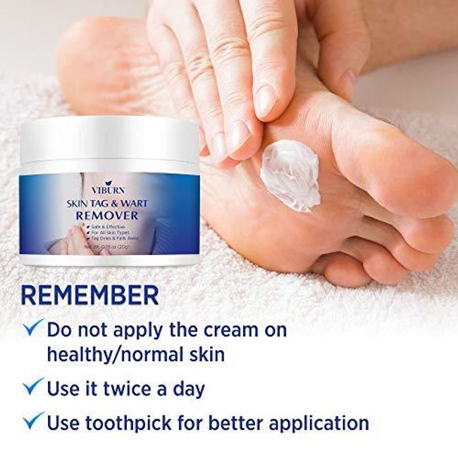 Skin Mole Removal Cream