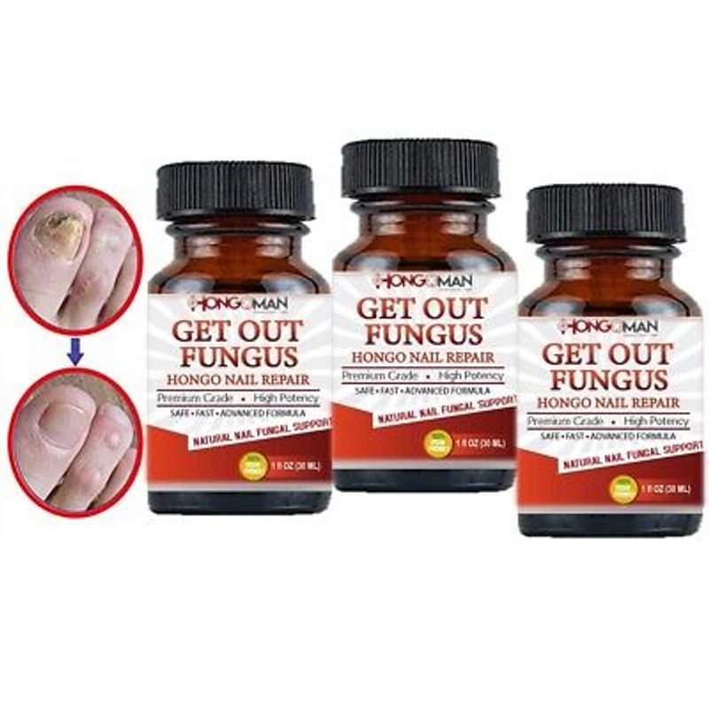 3 ANTI-FUNGAL Support STRENGTH TOENAIL FUNGUS ATHLETES FOOT FUNGI NAIL ...