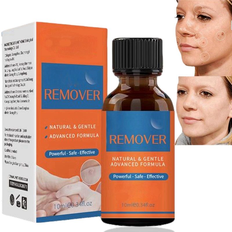 Warts & Mole Remover Cream,Natural Skin Tag Remover,Skin Tag Remover ...