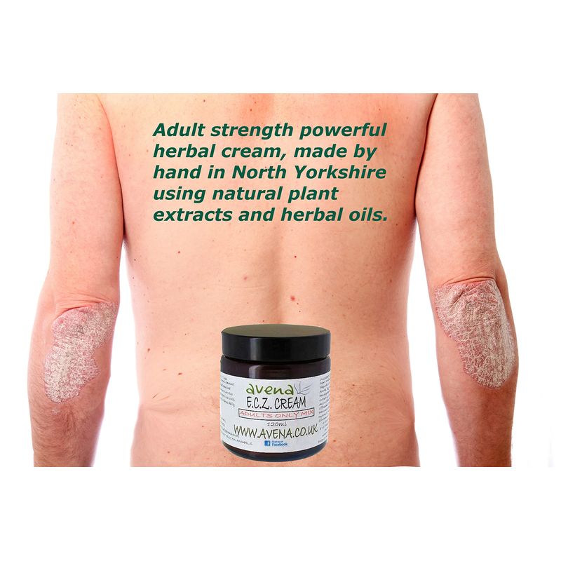 Eczema Cream Ultra Repair Cream Emulsifying Ointment Face Cream Exma ...