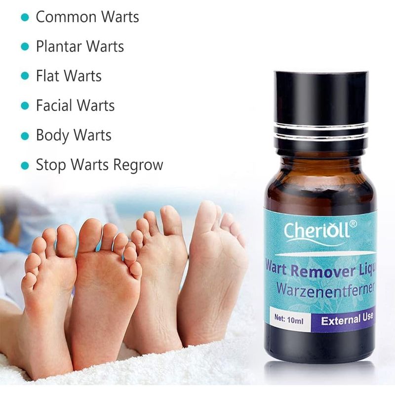 Wart Remover, Plantar Wart Remover, Natural Wart Remover, Hand and ...