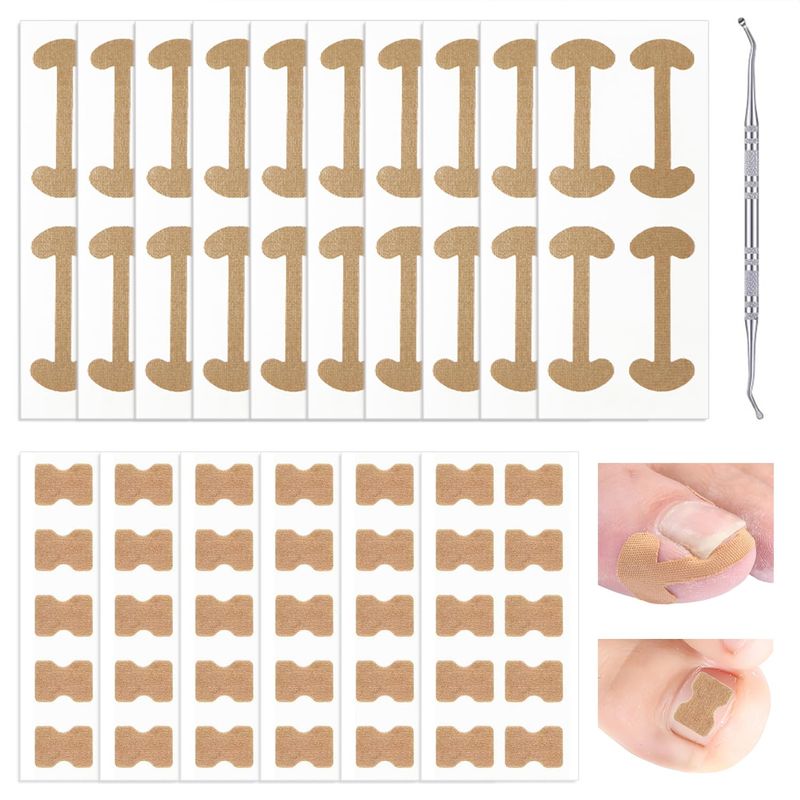 vaolmlop Ingrown Toenails Tool Set, Toenail Correction Patch, Ingrown ...