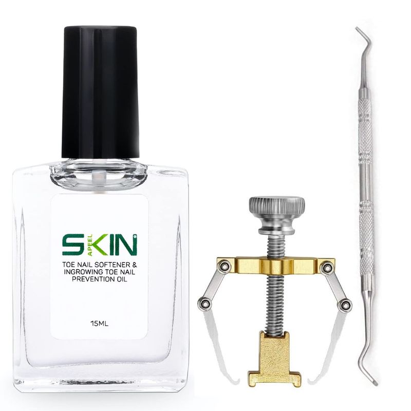 Ingrown Toenail Kit SKINAPEEL Toe Nail Softener and Ingrown Toenail ...