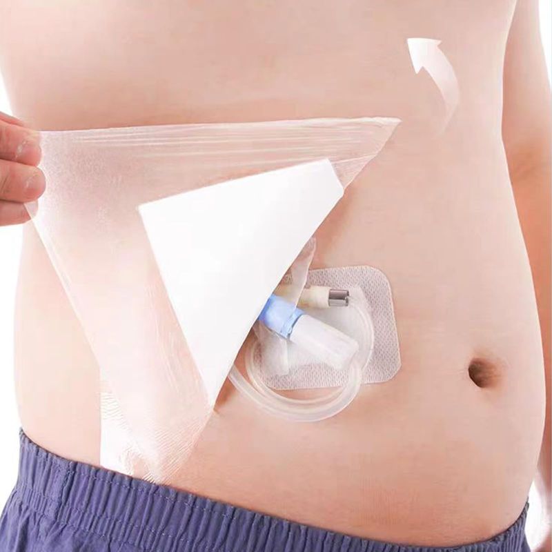 Waterproof Wound Bandage Patches with Absorbent Gauze Pads, Large Wound ...