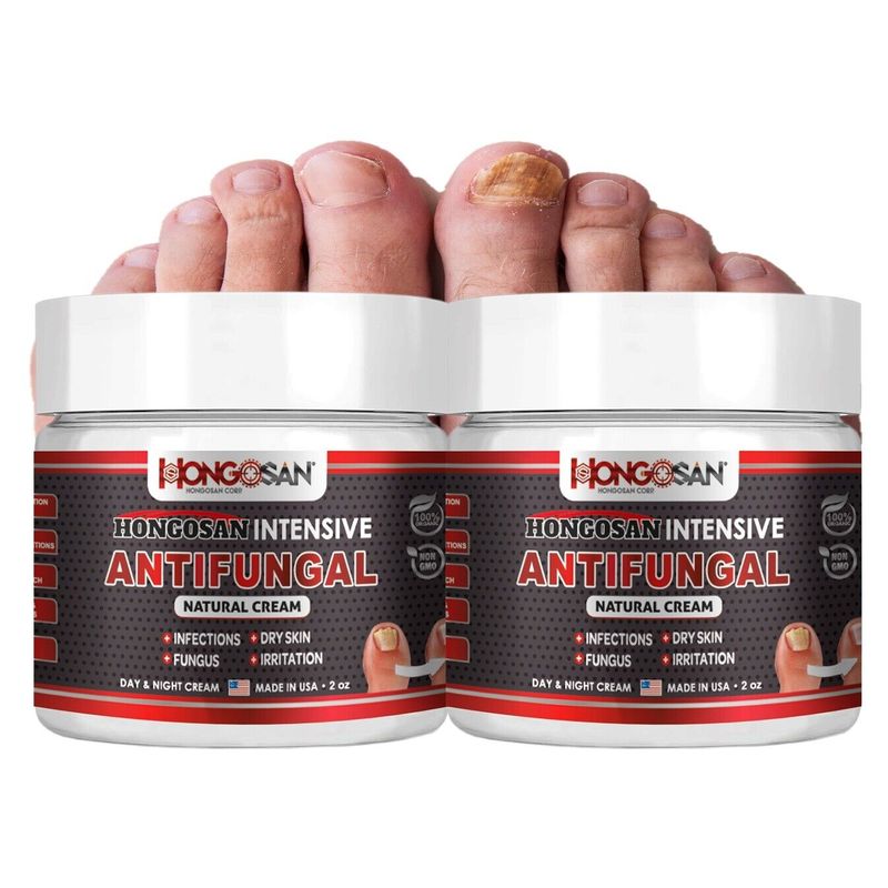 TeaTree Oil Antifungal Cream Balm Athletes Foot,Eczema,Jock,Itch ...