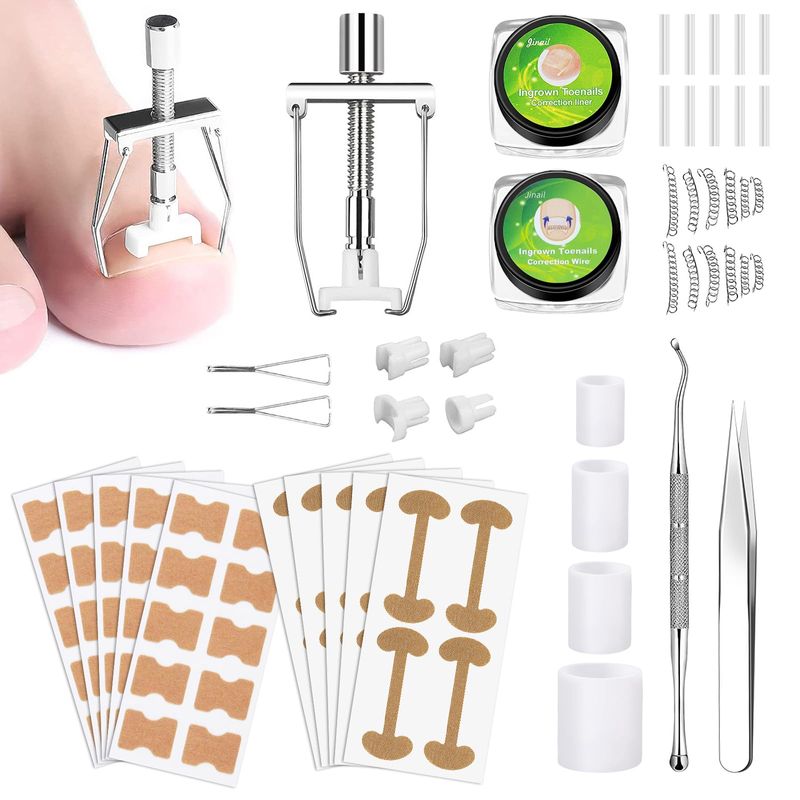 Ingrown Toenail Removal Kit Ingrown Toenail Treatment Tool Kit Ingrown ...