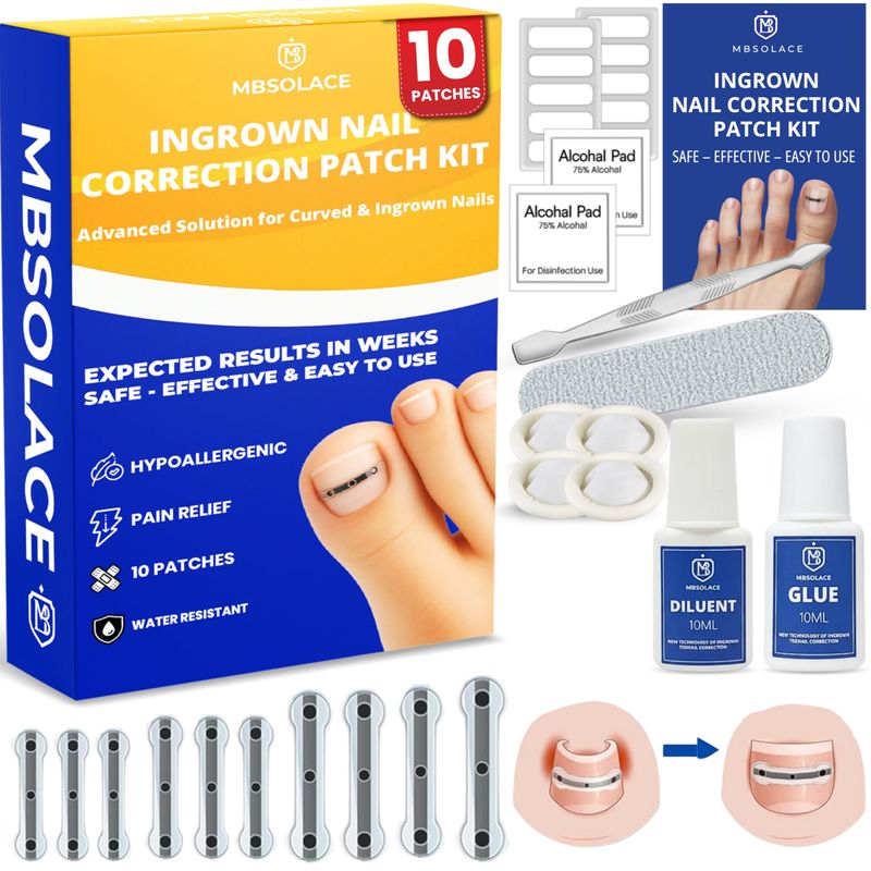 4 Sizes, Titanium Alloy Ingrown Toenail Treatment & Corrector Kit ...
