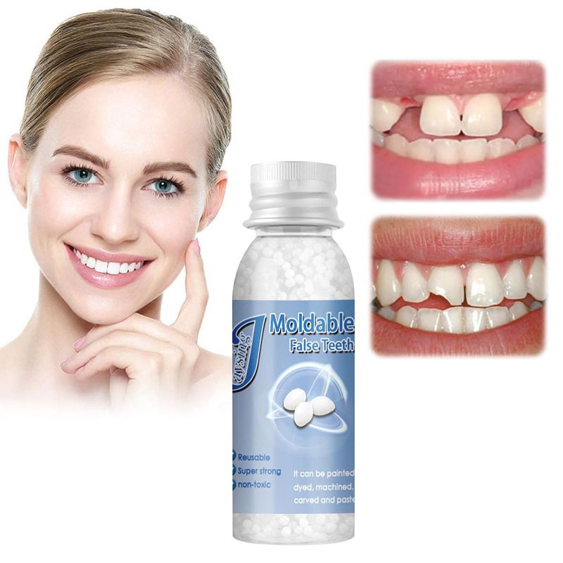 Tooth Filling Repair Kit,Temporary Tooth Filling, Denture Repair Beads ...
