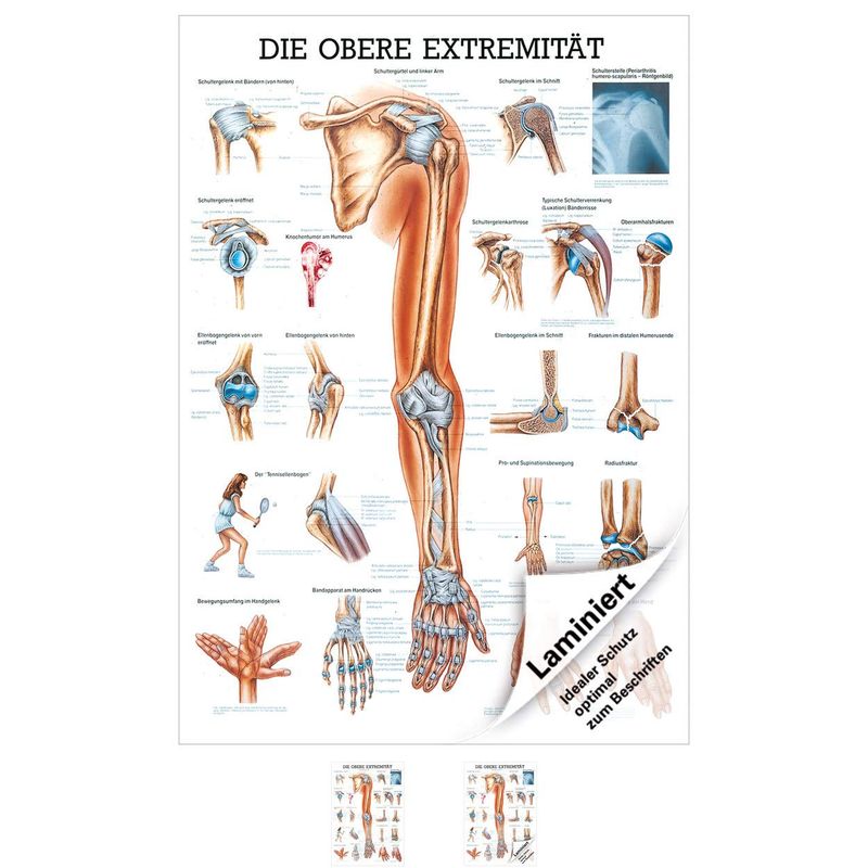 Rüdiger Upper Extremity Anatomy Chart 100 x 70 cm Medical Teaching Aid ...