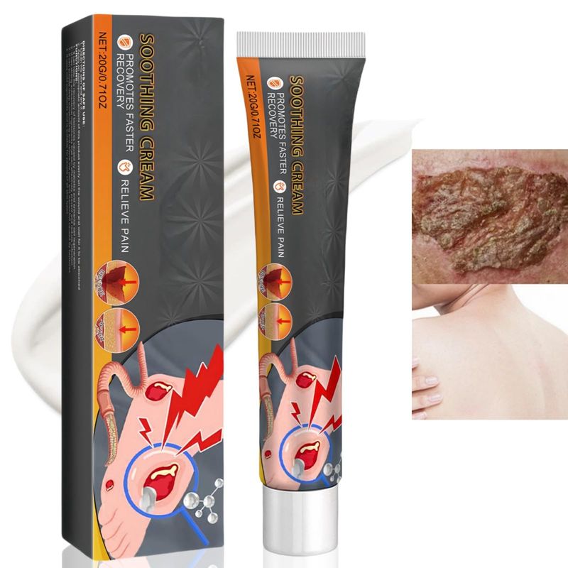 Bed Sore Cream,Bed Sore Wound Treatment Cream,Bedsore Wound Care ...