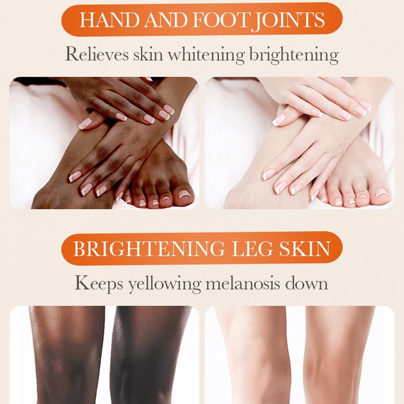 5.2oz Dark Knuckle Whitening Cream,Skin Body Bleaching For Dark Knees ...