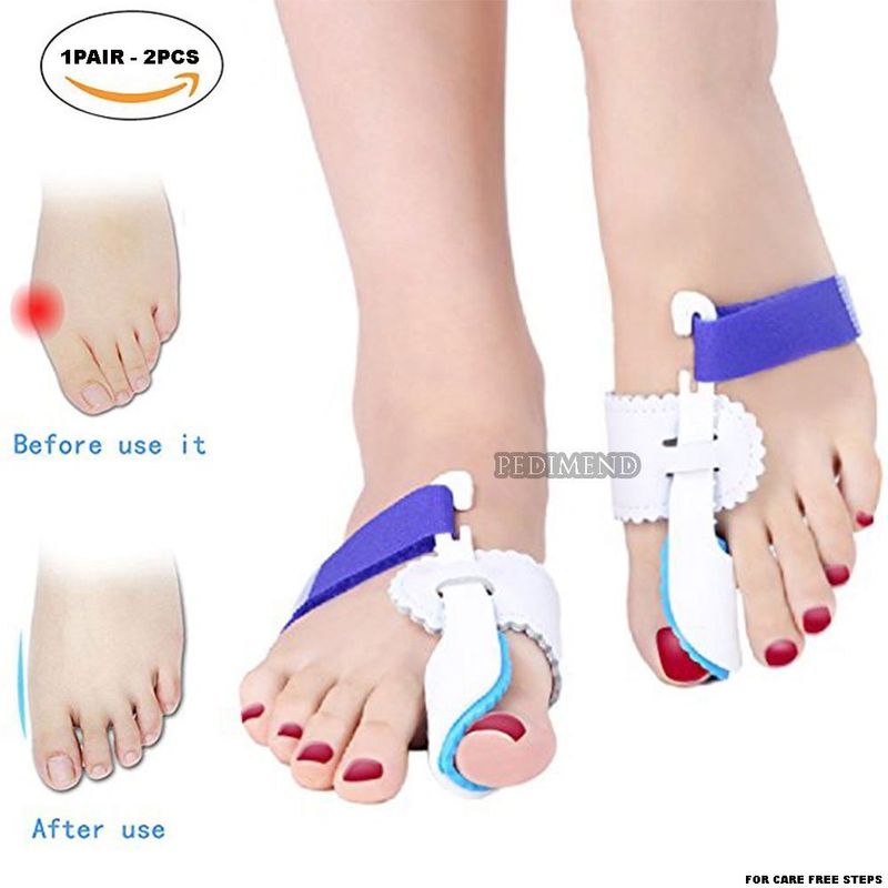 Hallux Valgus A Pair of Big Toe Bunion Straighteners Night Splint Pad ...