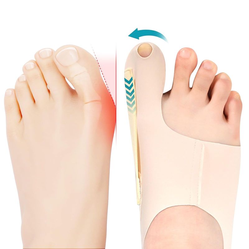 1 Pair Bunion Corrector Big Toe Straightener, Epitact Bunion Corrector ...
