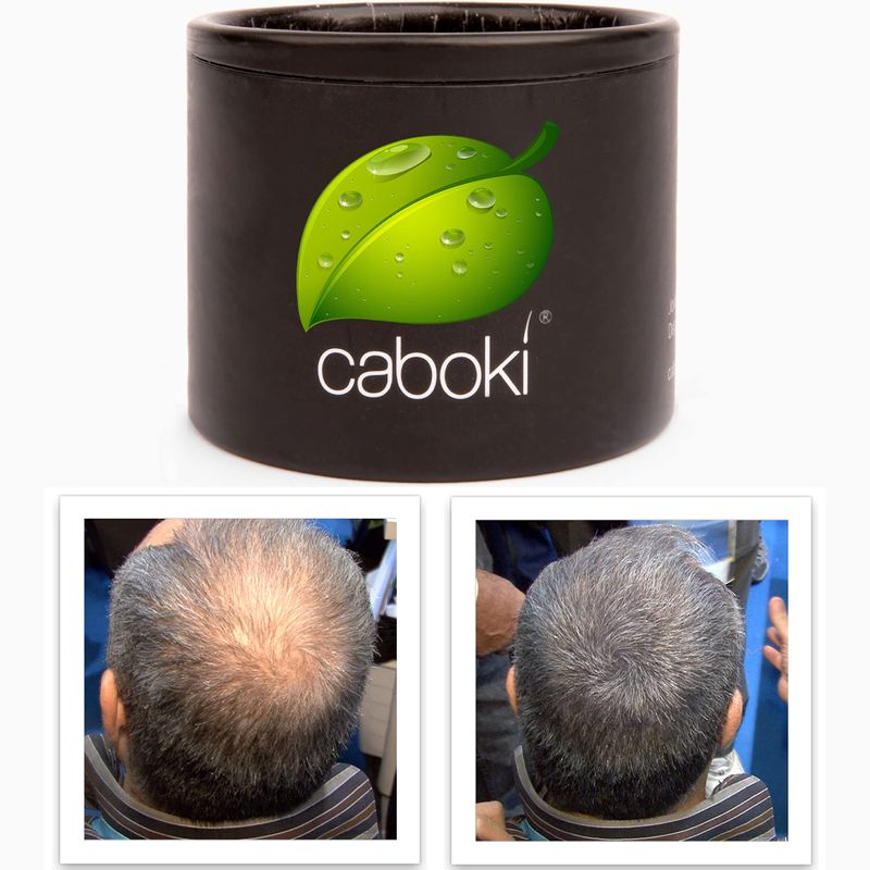 Hair Fibers For Hair Loss. Cover Bald Spot and Thinning Hair Instantly ...