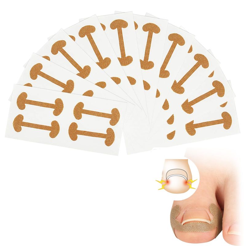 Pack of 40 Toenail Correction Patches, Ingrown Toenails, Nail ...