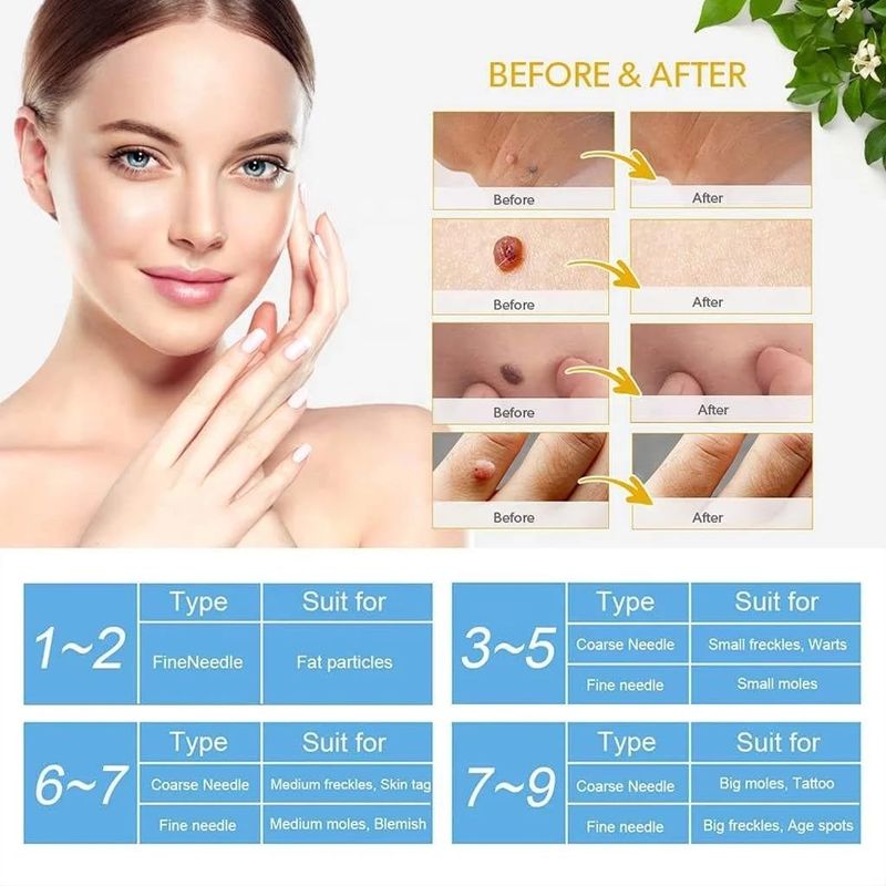 Laser Skin Tag Removal Pen Skin Tag Removal Kit, Mole Remover with 9 ...