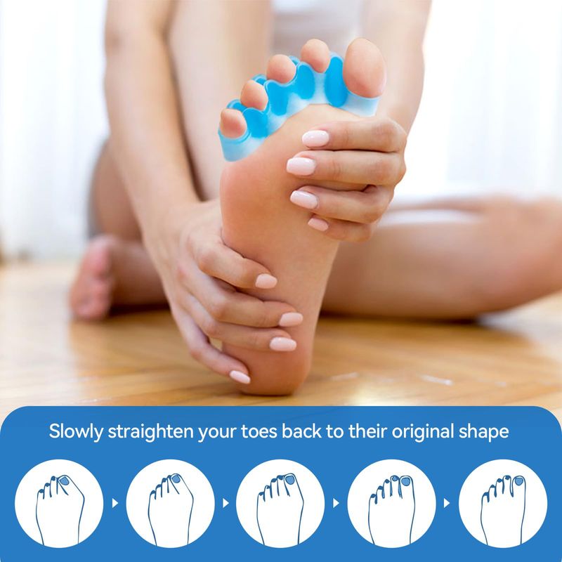 Sumiwish Toe Separators & Toe Spacers - 4 Pairs (Blue and White) - Soft ...