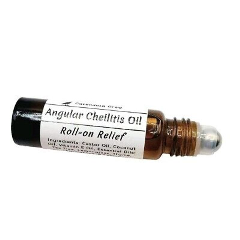 Angular Cheilitis Oil - 10ml Roller - CHEILITIS Lip Oil - Online ...