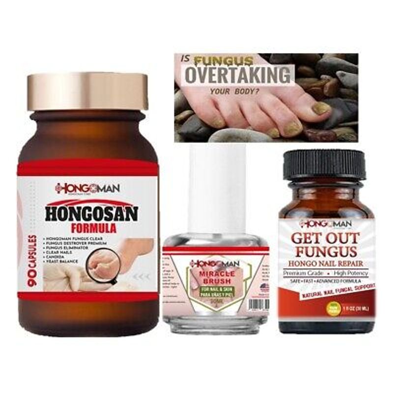 Anti-fungal cream athletes foot toenail support Hongos fungus toe nail ...