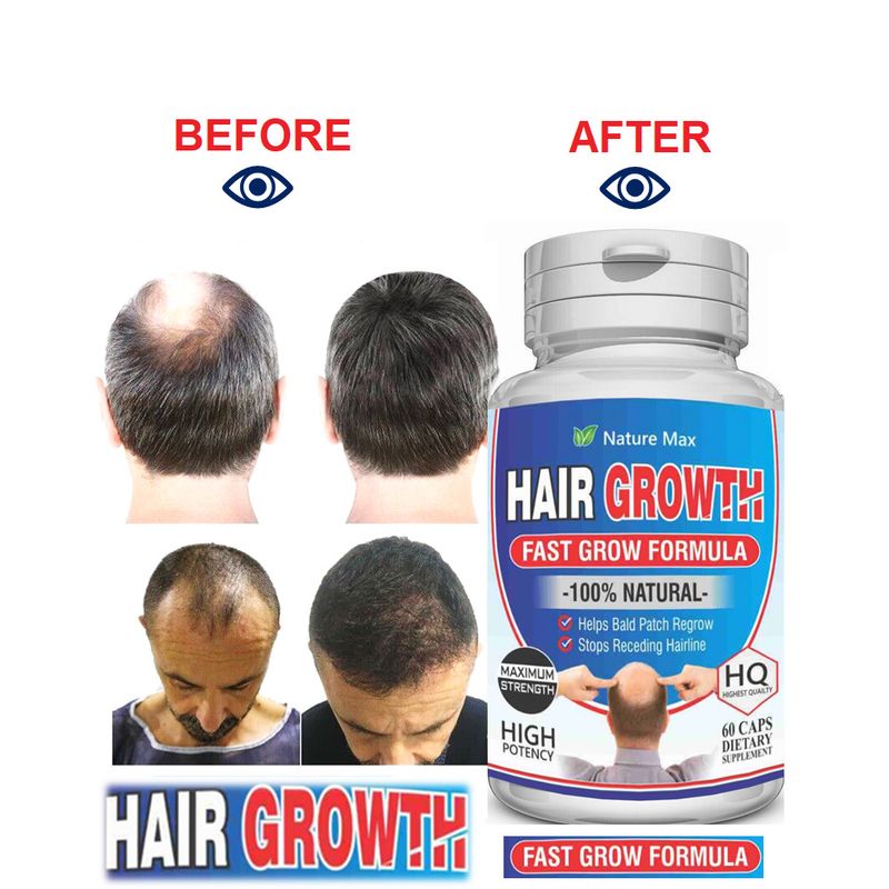 HAIR Vitamin Anti Hair Loss Capsules - Online Marketplace - EveryMarket