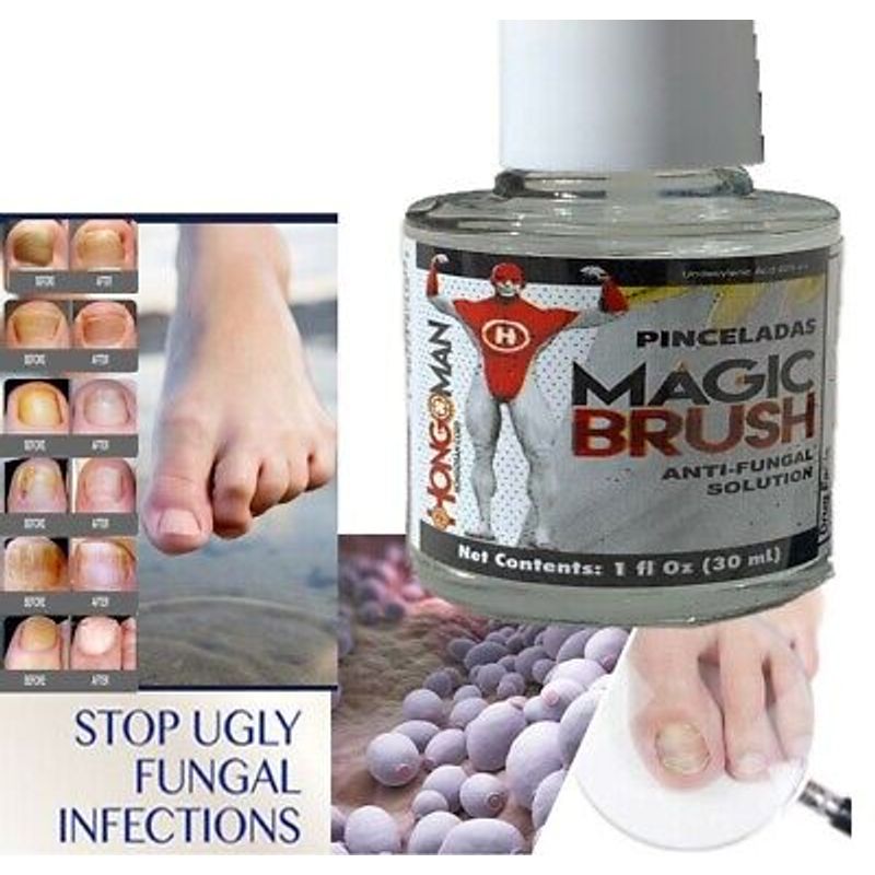 Anti-Fungal Nail Cuticle Support Solution For Toes Fingers Max 100% ...