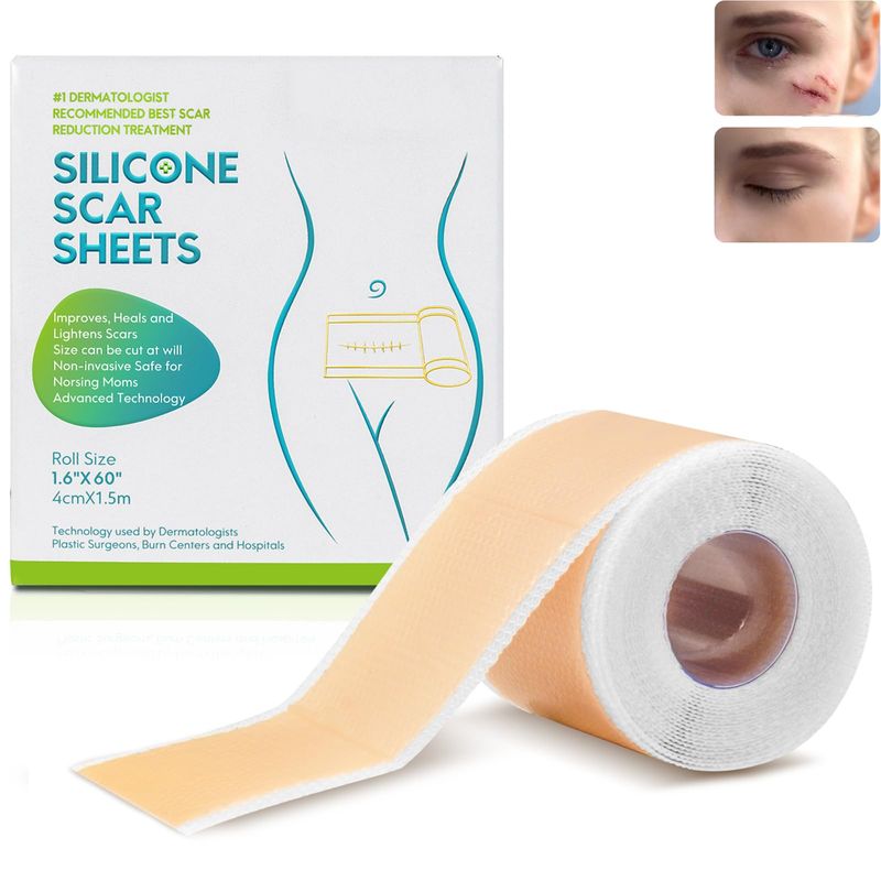 Silicone Scar Sheets, Painless Silicone Scar Tape Roll, Medical ...